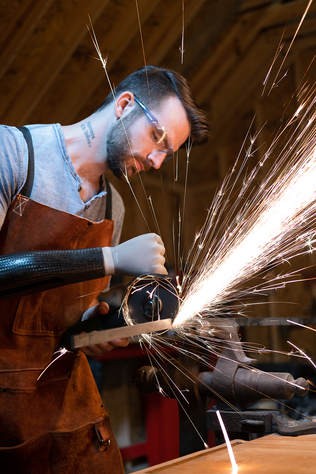 Prótesis de Brazo y Mano con alta tecnología | Interbionic